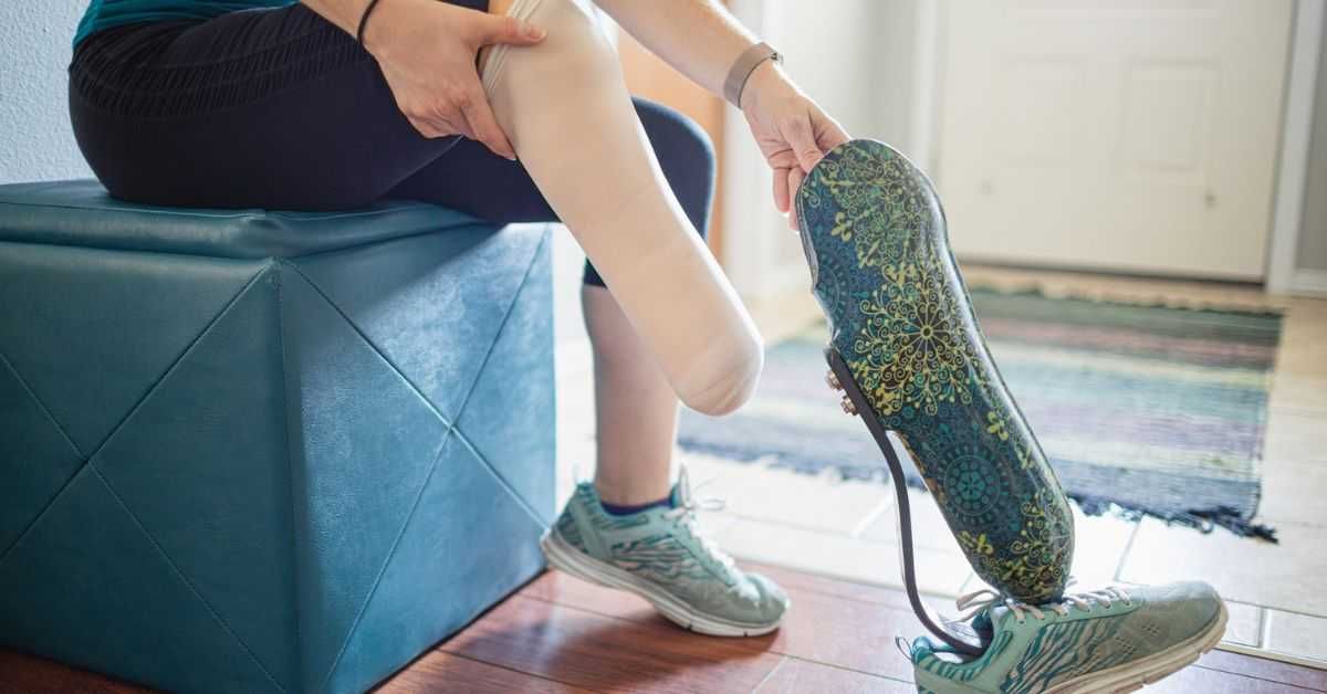 Woman Won't Remove Prosthetic Leg Around BF